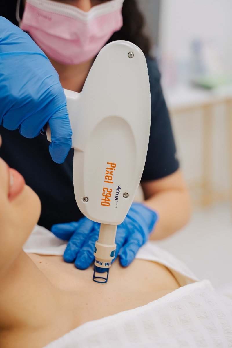 Fractional Laser | TheAntiagers - Αισθητικές λύσεις - Πλαστική Χειρουργική